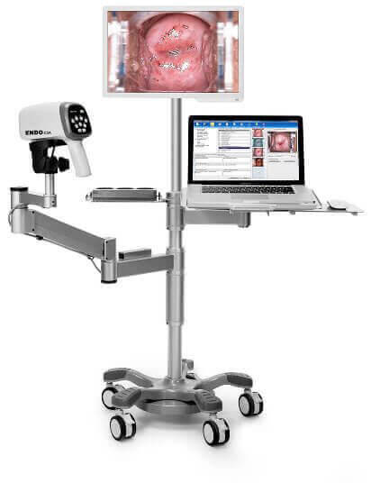 Video Colposcope, ENDO C3A | PT ENDO Indonesia