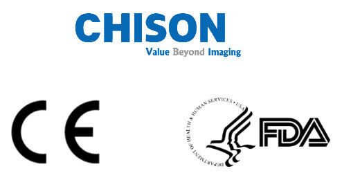 USG Color Doppler, Chison i8 | PT ENDO Indonesia