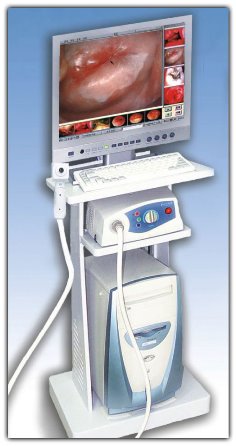 Videoscope Medis Otoscope Colposcope Opthalmoscope, Visco Focus-9 | PT ...